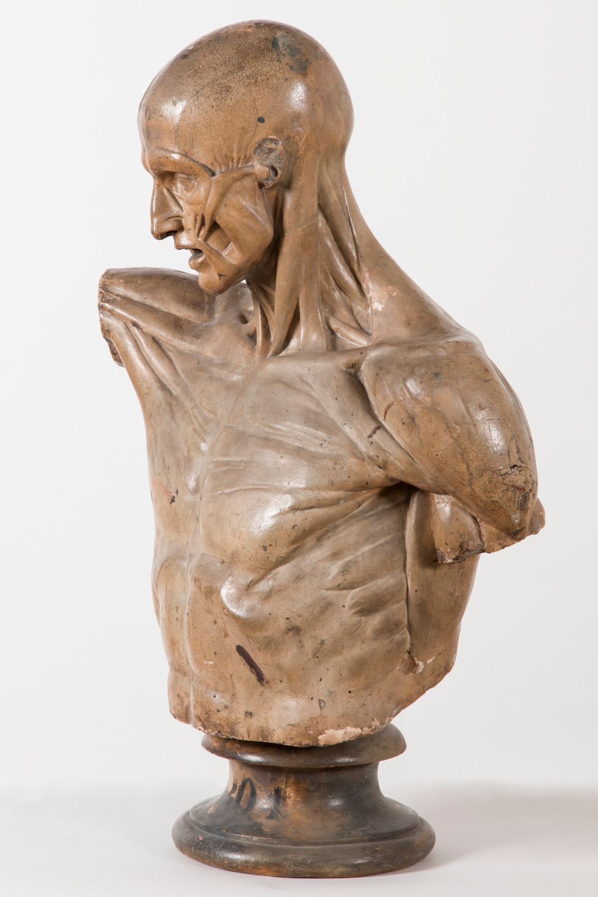 Écorché au bras tendu [Head and torso only] | Works of Art | RA ...
